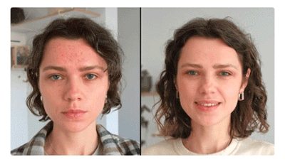 3-in-1 Mini Facial Toning & Rejuvenation Device